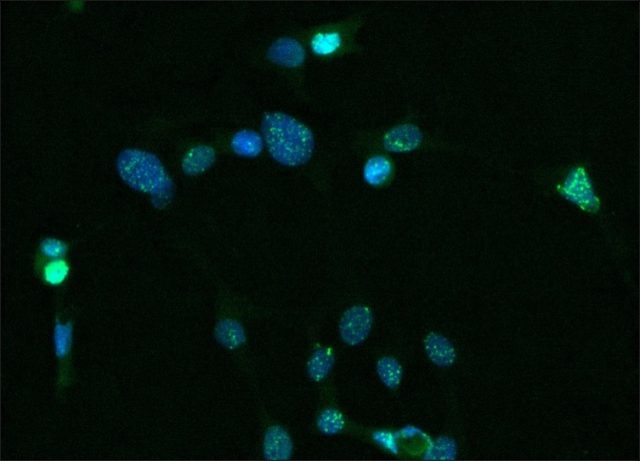 SNOLAB | World-class underground science facility